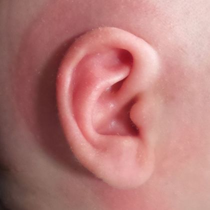 Gallery | Ears R Us | NYC and Trumbull, CT