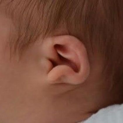 Gallery | Ears R Us | NYC and Trumbull, CT