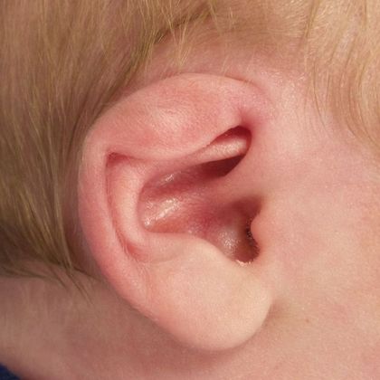 Gallery | Ears R Us | NYC and Trumbull, CT