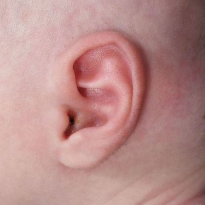 Gallery | Ears R Us | NYC and Trumbull, CT