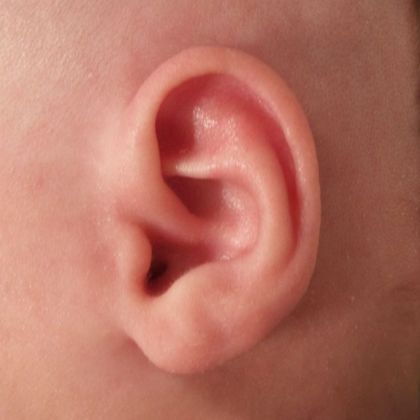 Gallery | Ears R Us | NYC and Trumbull, CT